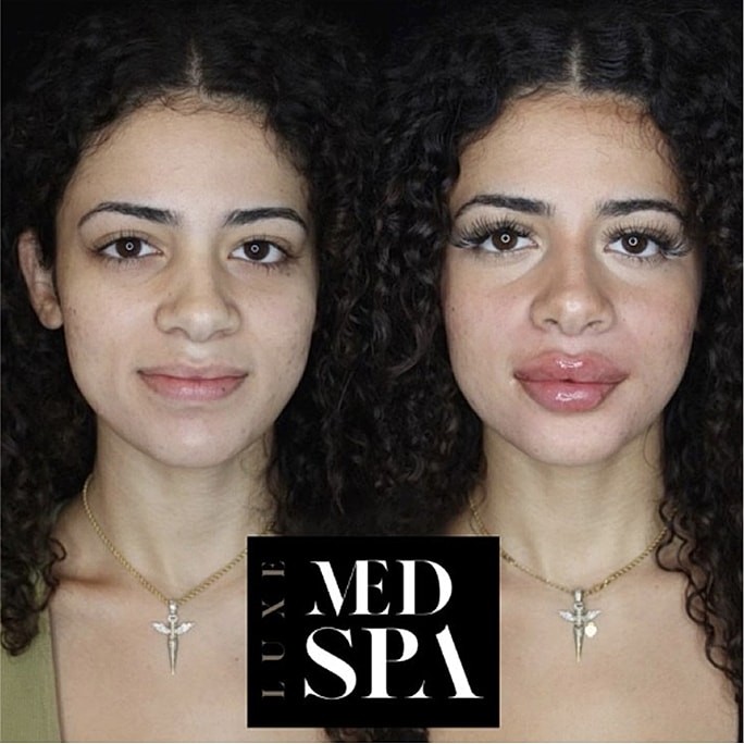 Luxe Med Spa Aesthetics