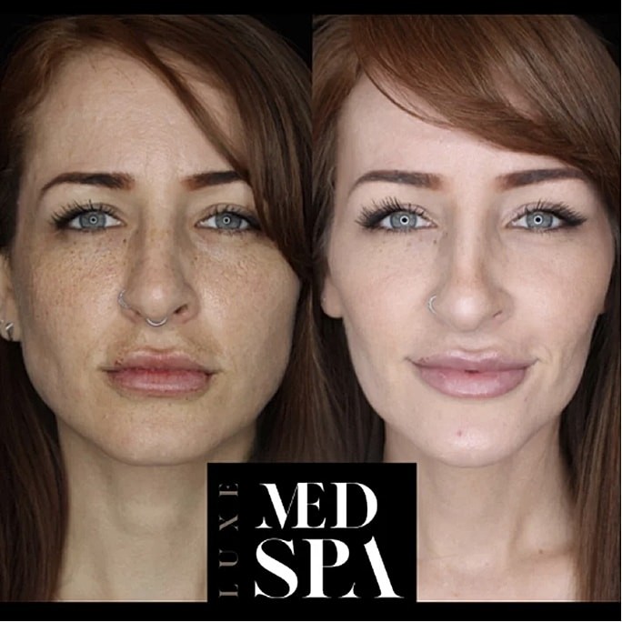 Med Spa in Orlando, FL | Botox, Fillers, Facials & Laser Treatments